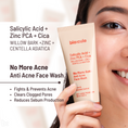 No More Acne Anti Acne Face Wash – biocule